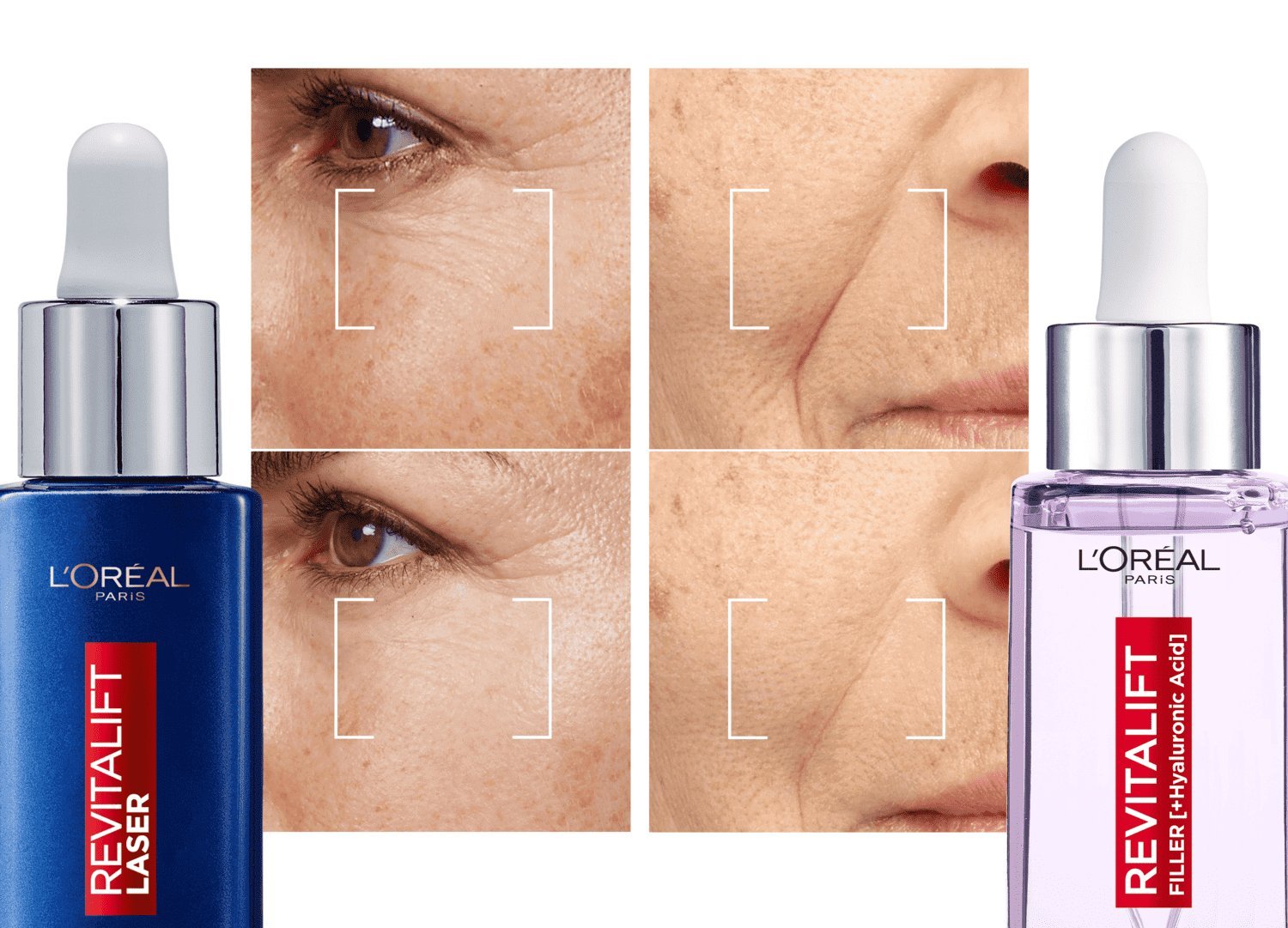 Ácido Hialurónico y Retinol: Un match para transformar tu piel